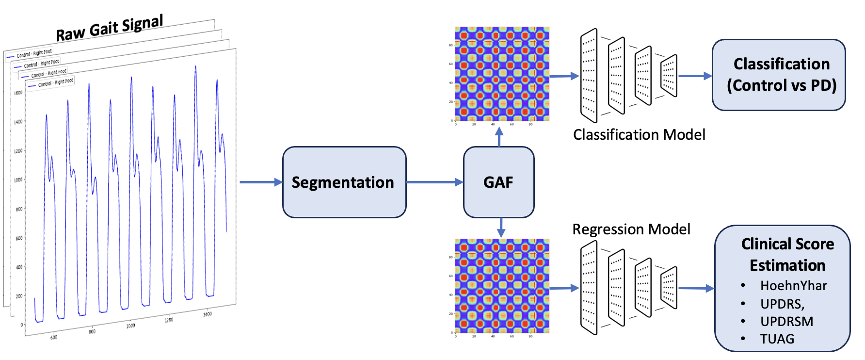 Detection and Severity Assessment of Parkinson’s Disease by Analysis of ...